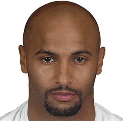 Scalp Micropigmentation | SMP Hair Good Look Ink